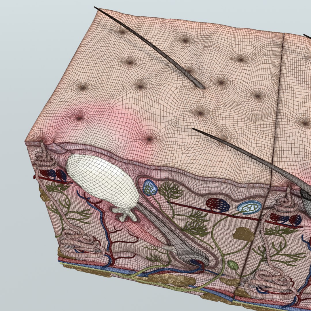 Realistic Skin Acne Anatomy 3D Model - TurboSquid 1164399