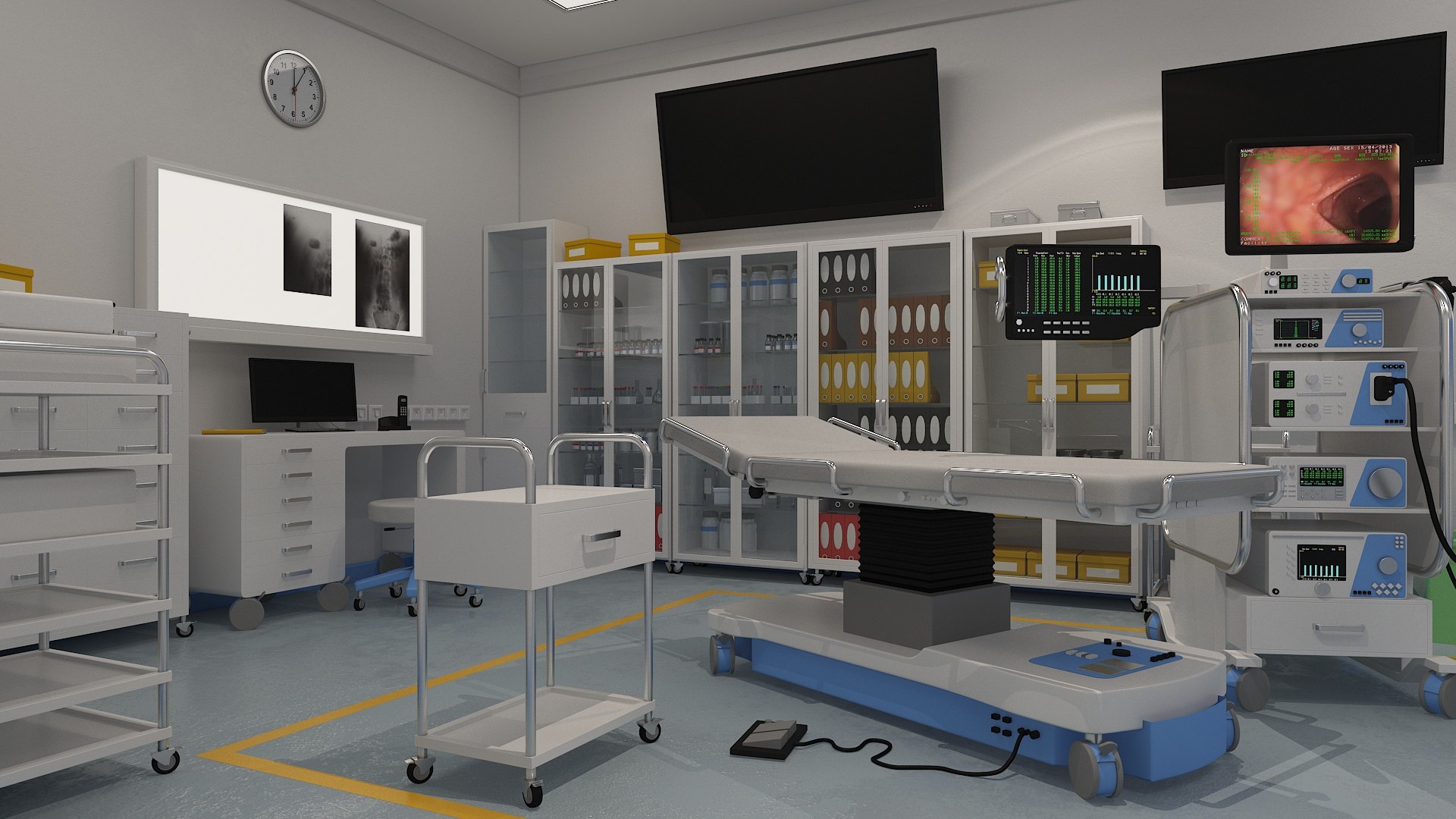 Endoscopy Room 3D - TurboSquid 2235458