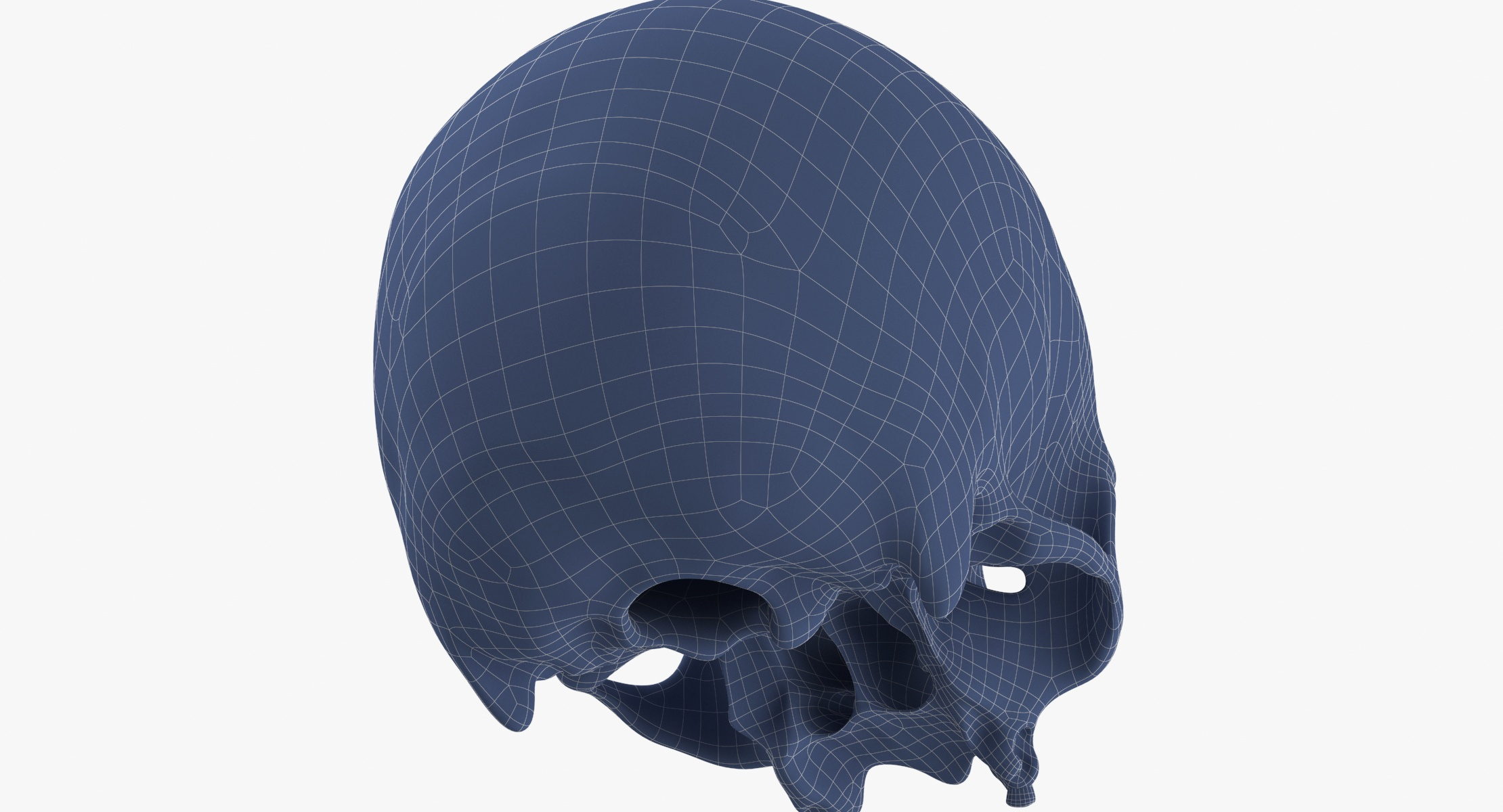 Human skull cranium leprosy 3D model - TurboSquid 1662437