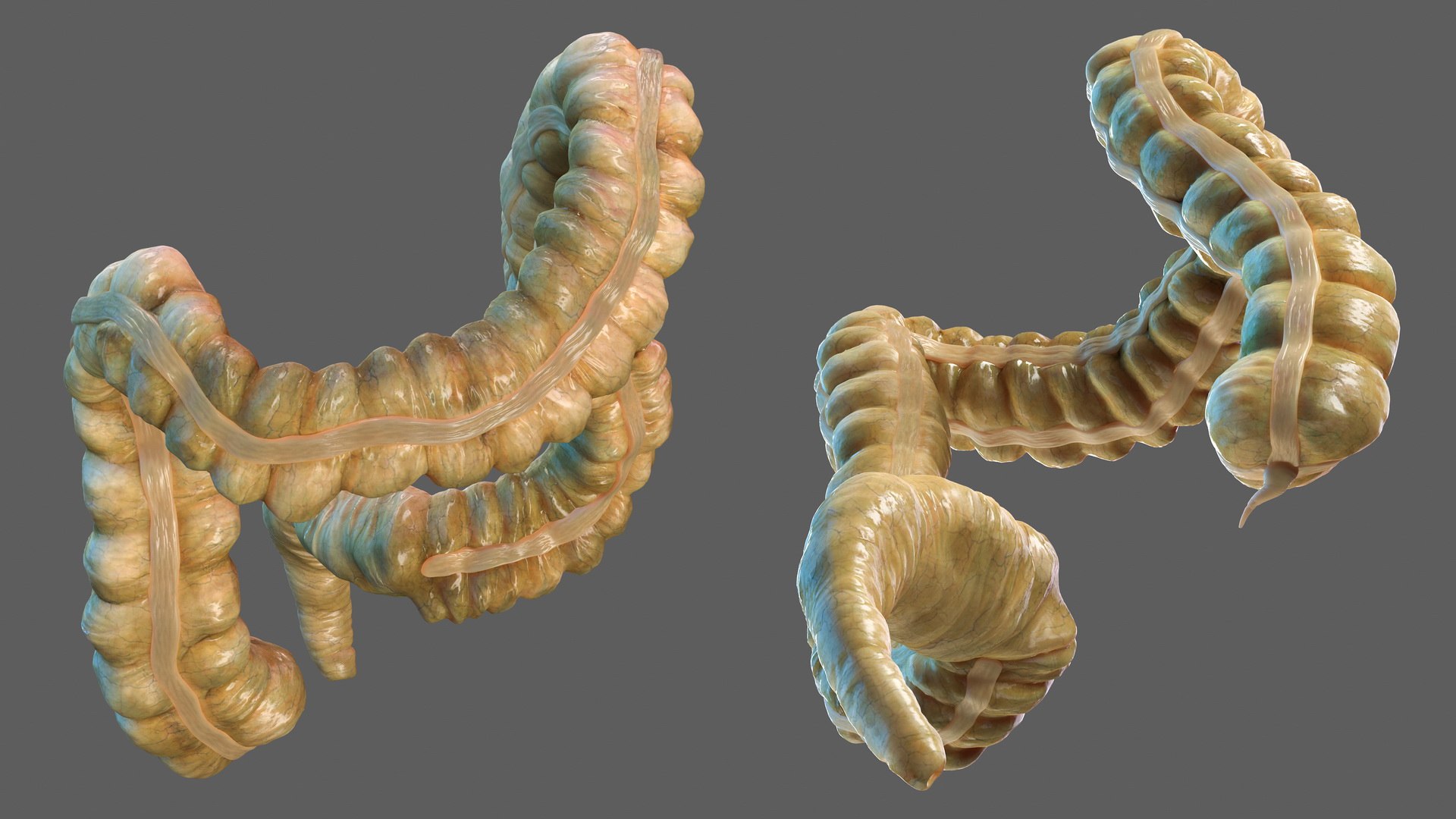 Human Colon 3D Model - TurboSquid 1467055