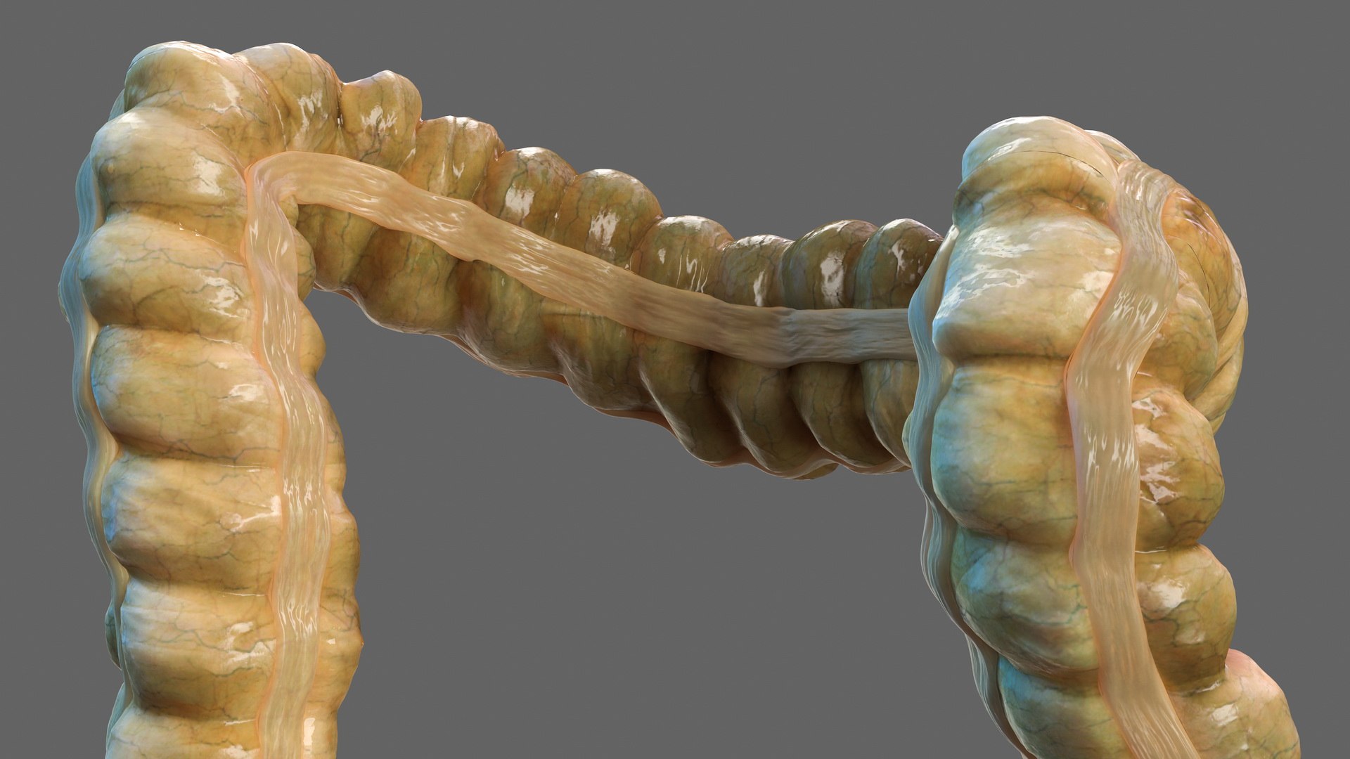 Human Colon 3D Model - TurboSquid 1467055