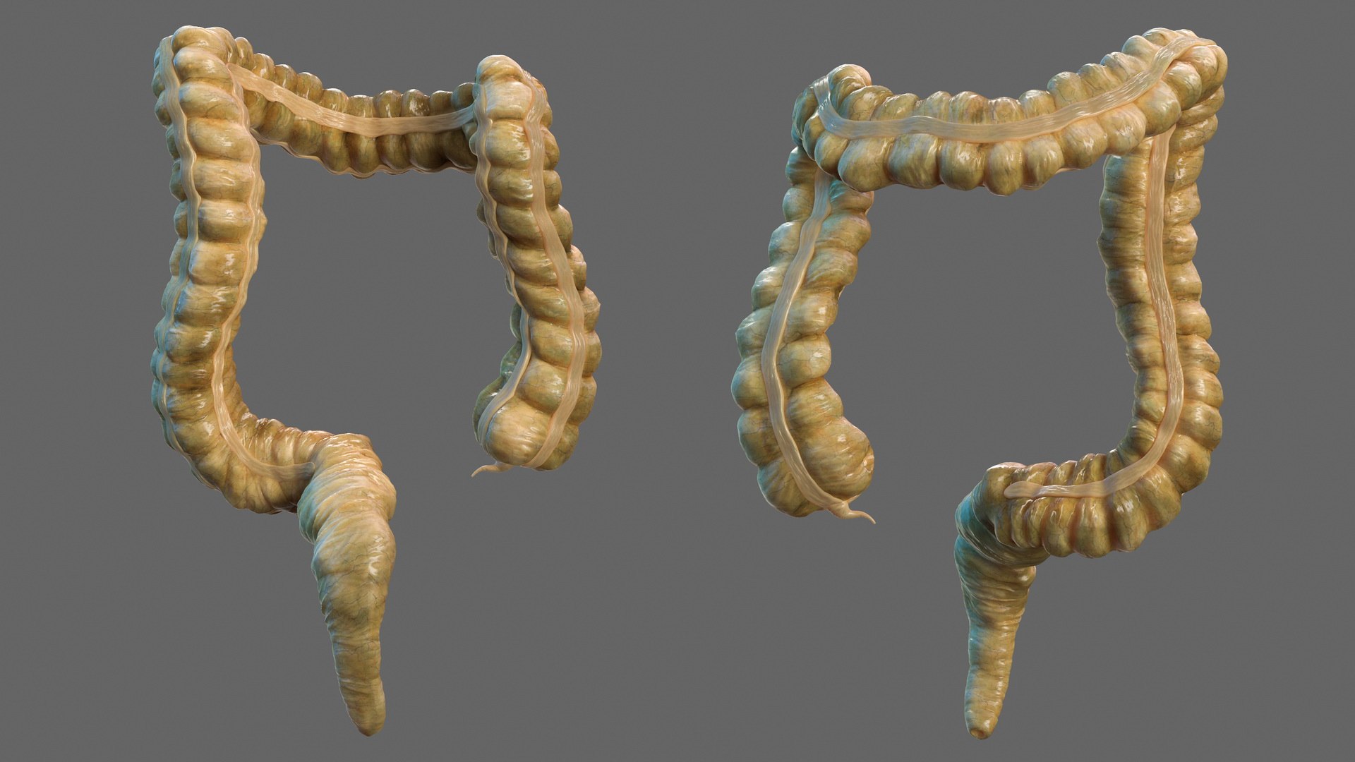 Human Colon 3D Model - TurboSquid 1467055
