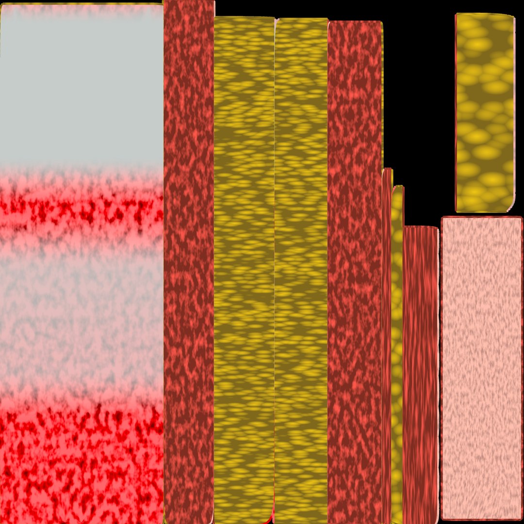 3D Hypertension Blood Vessel Artery Structural Change Model ...