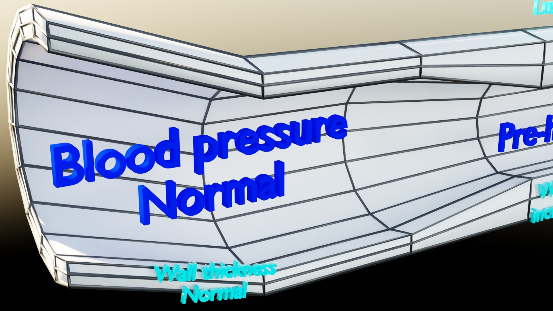 3D Hypertension Blood Vessel Artery Structural Change Model ...
