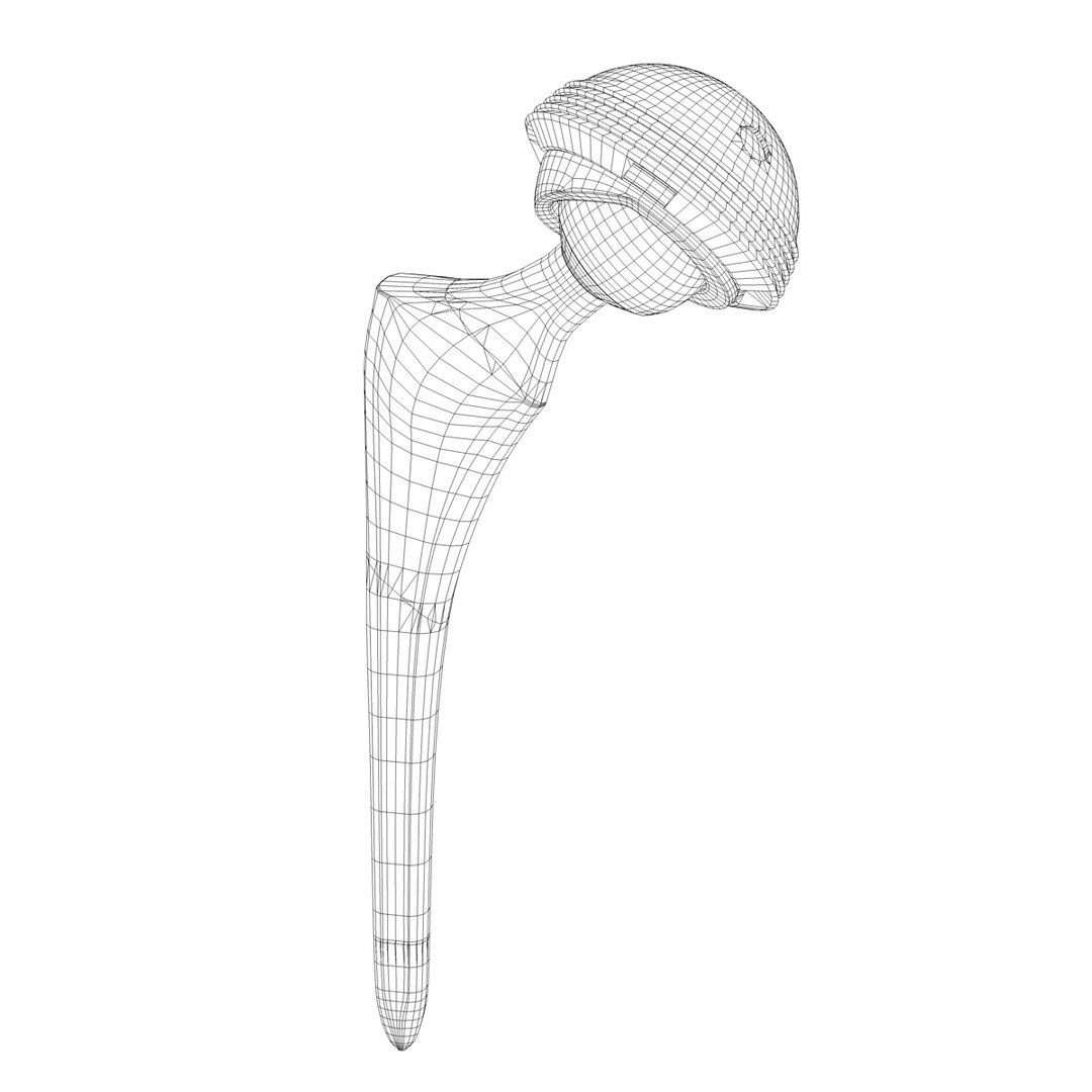 Femoral prosthesis 3D - TurboSquid 1264812