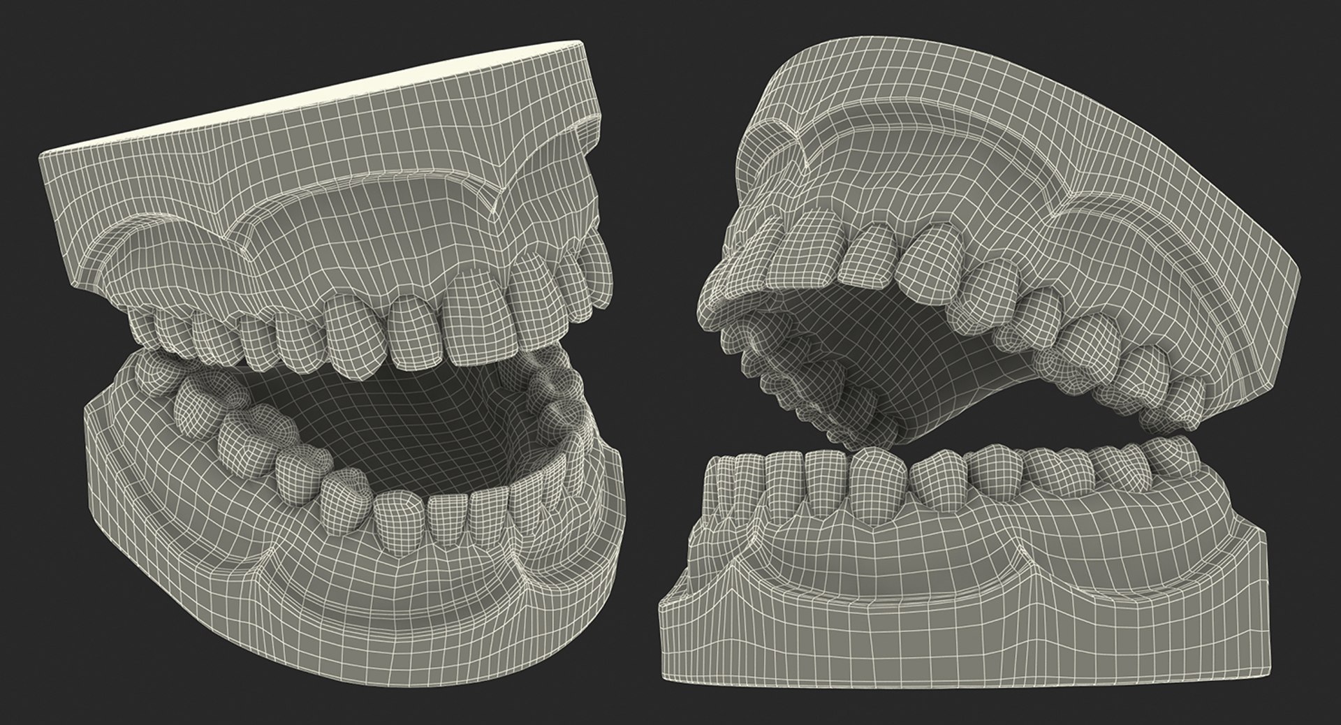 3D dental modeled human model - TurboSquid 1257324