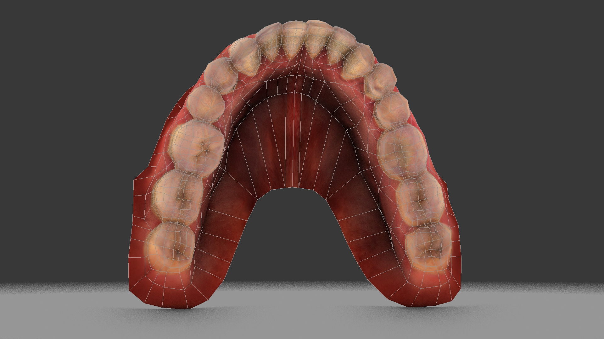 Denture medicine anatomy model - TurboSquid 1676572
