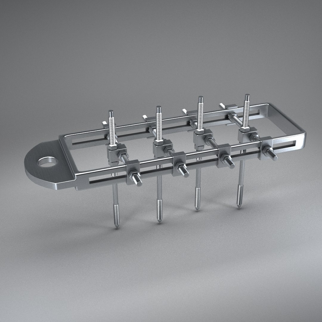 3dsmax Bone External Fixation Apparatus
