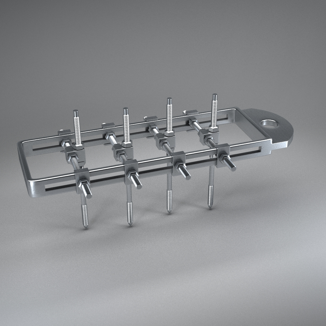 3dsmax Bone External Fixation Apparatus