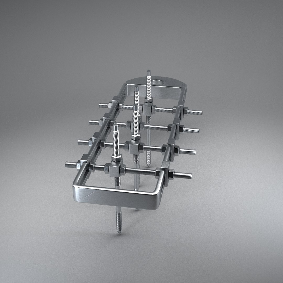 3dsmax Bone External Fixation Apparatus