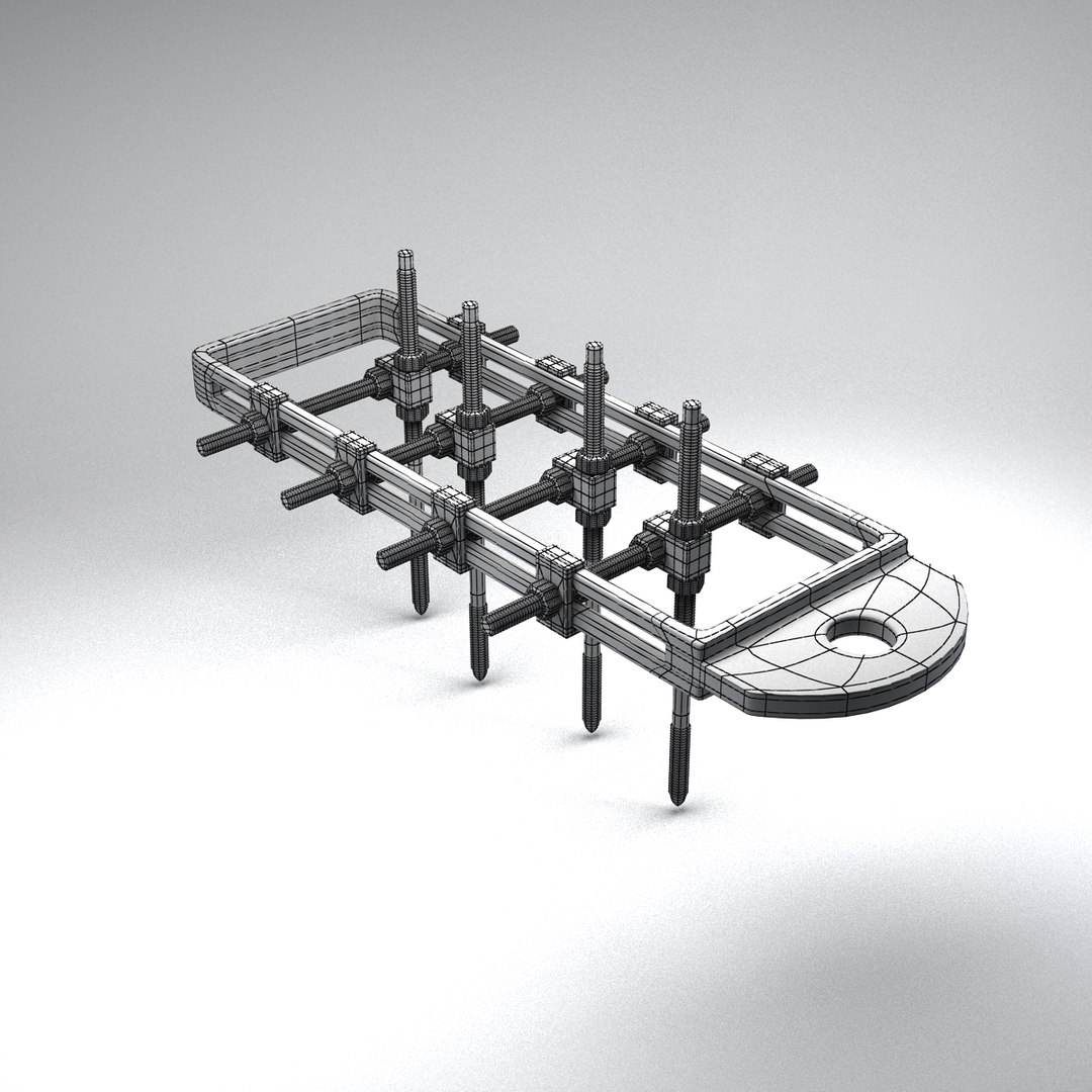 3dsmax Bone External Fixation Apparatus