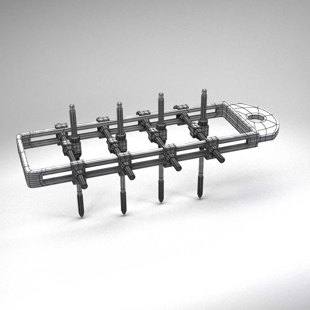 3dsmax Bone External Fixation Apparatus