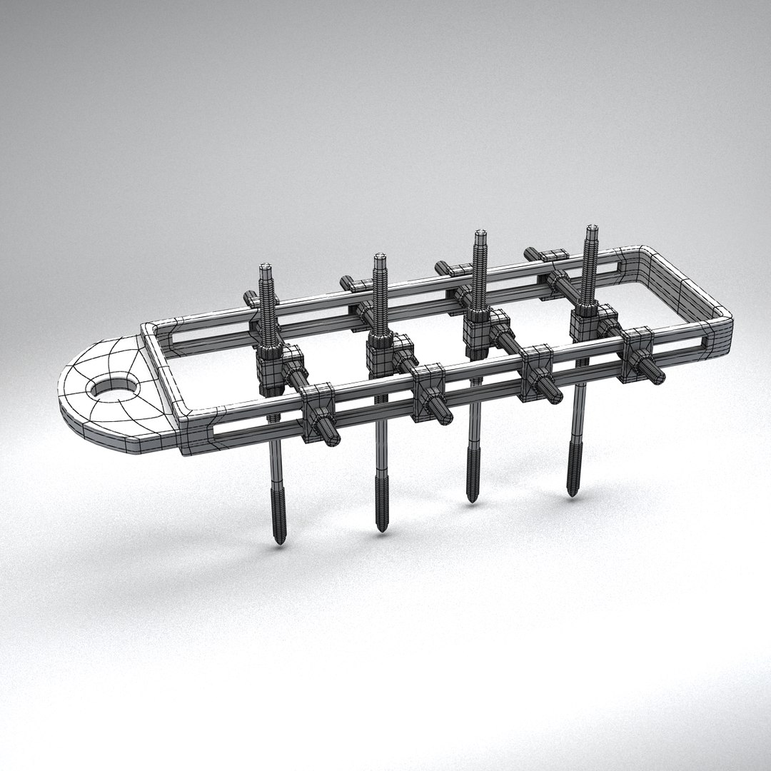3dsmax Bone External Fixation Apparatus