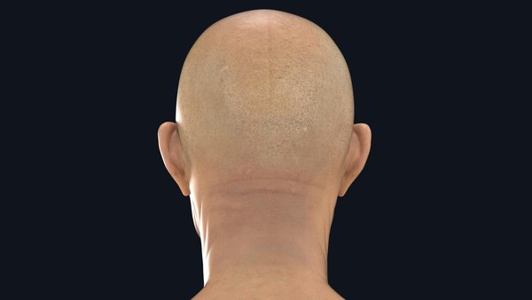 photorealistic body wounded character 3d model