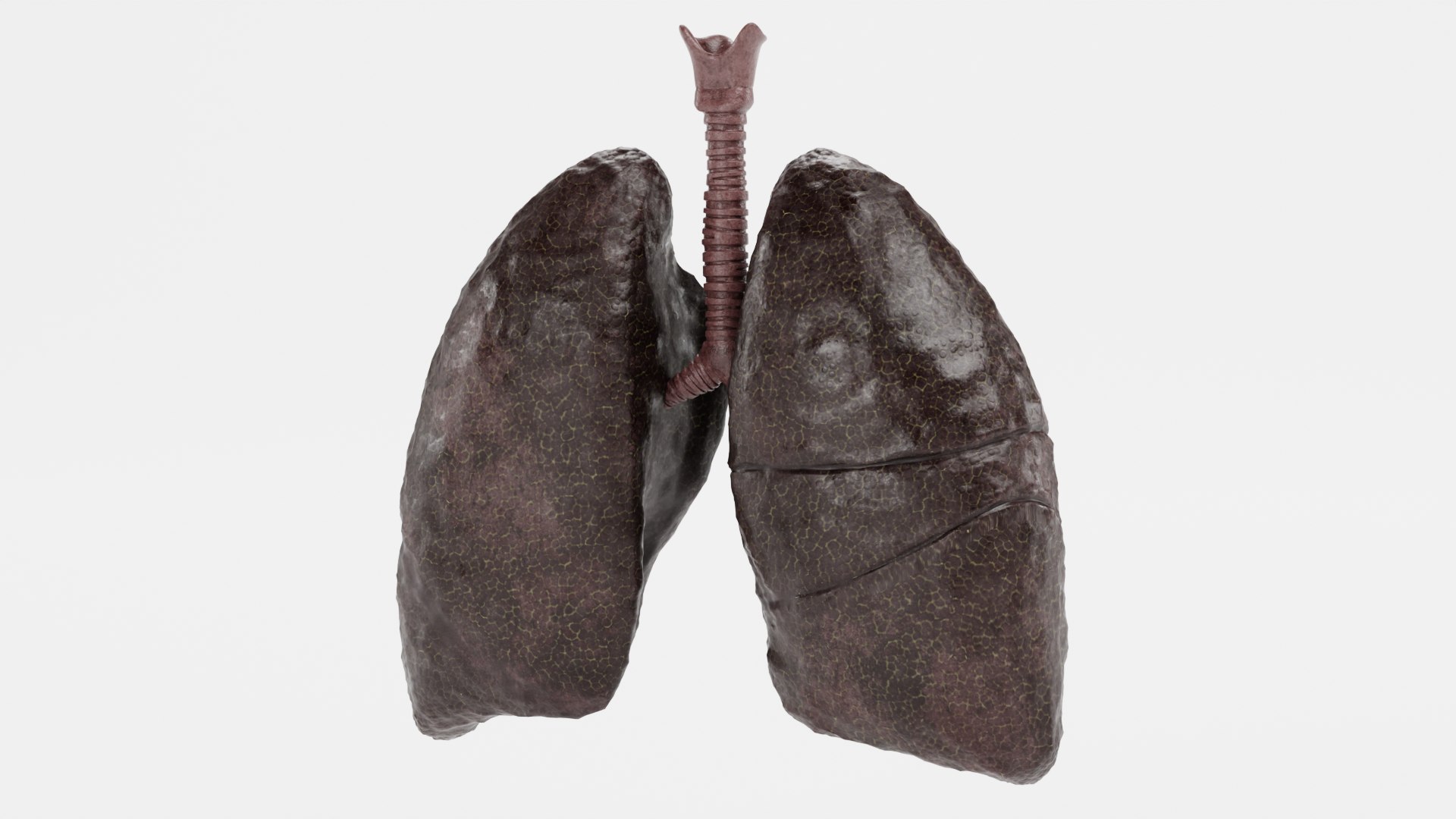 Smoker Lungs 3D Model - TurboSquid 1839098