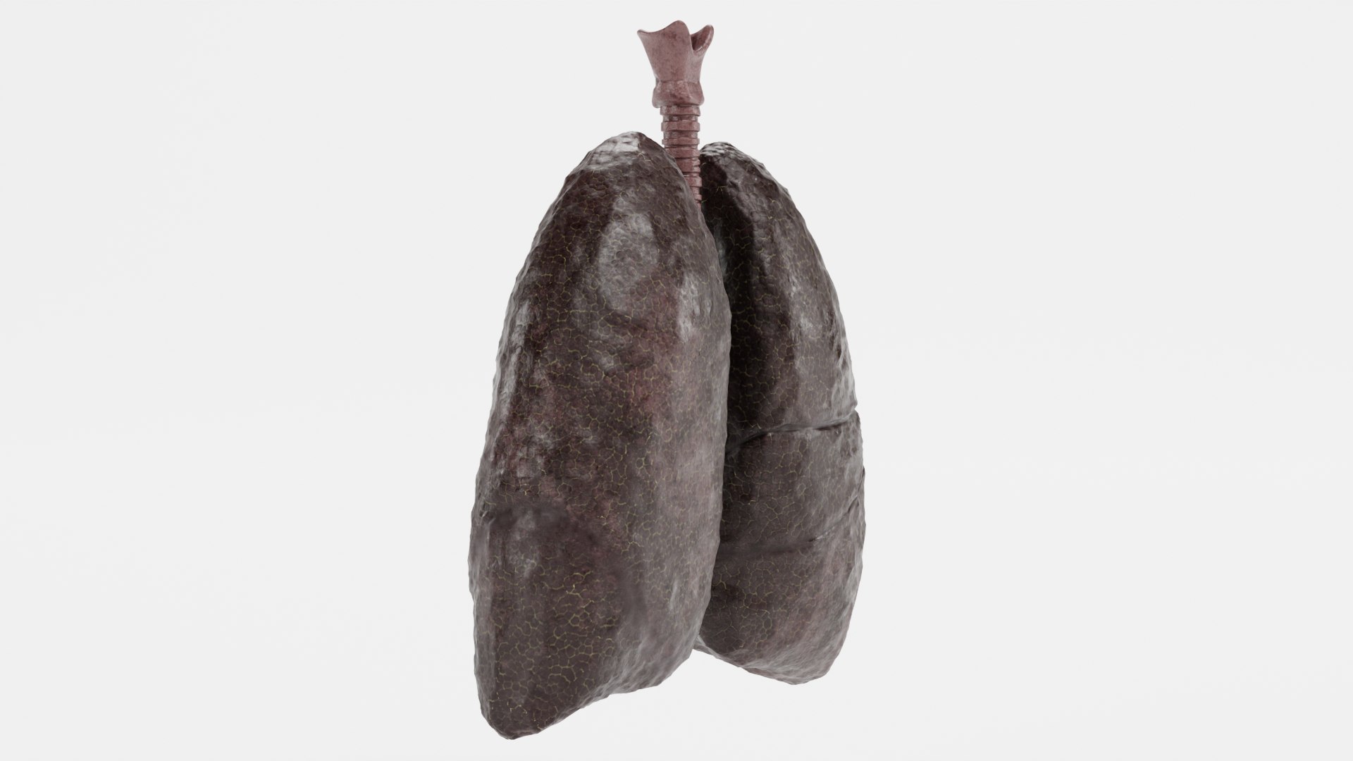 Smoker Lungs 3D Model - TurboSquid 1839098
