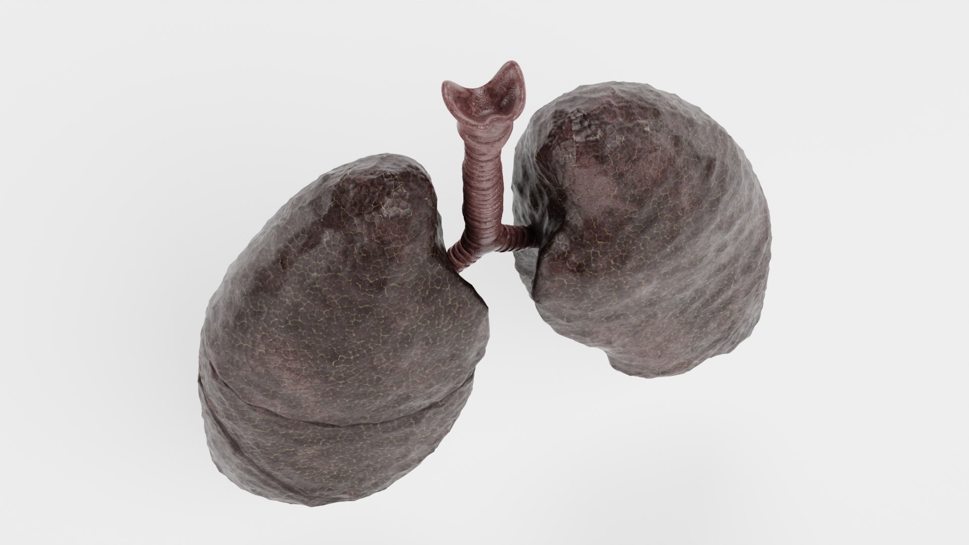 Smoker Lungs 3D Model - TurboSquid 1839098