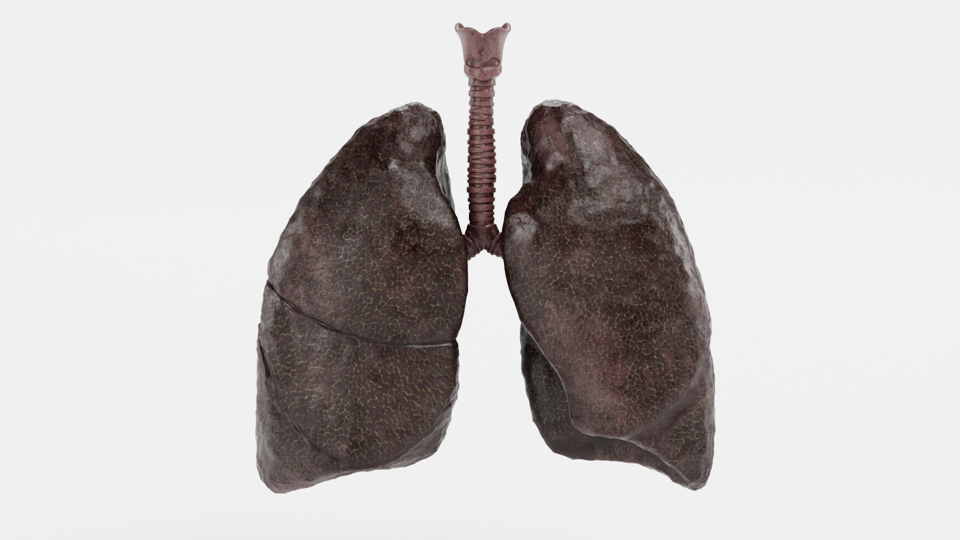 Smoker Lungs 3D Model - TurboSquid 1839098
