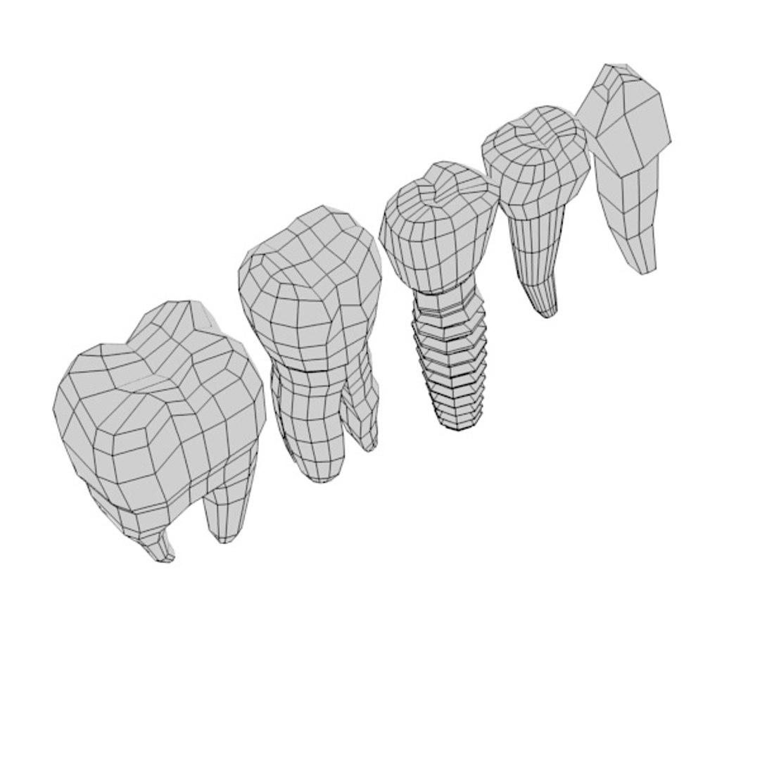 Dental Implant Teeth 3d Model