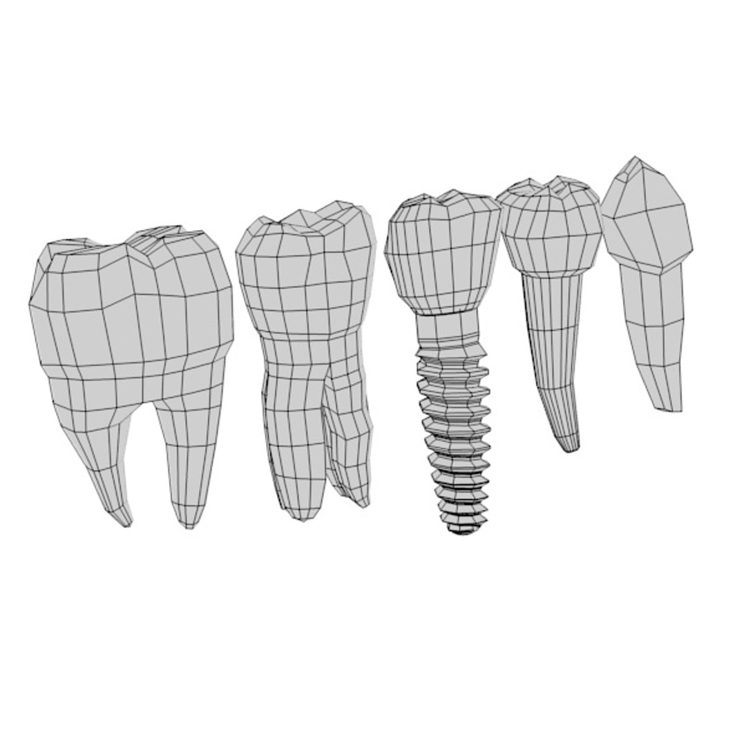 Dental Implant Teeth 3d Model