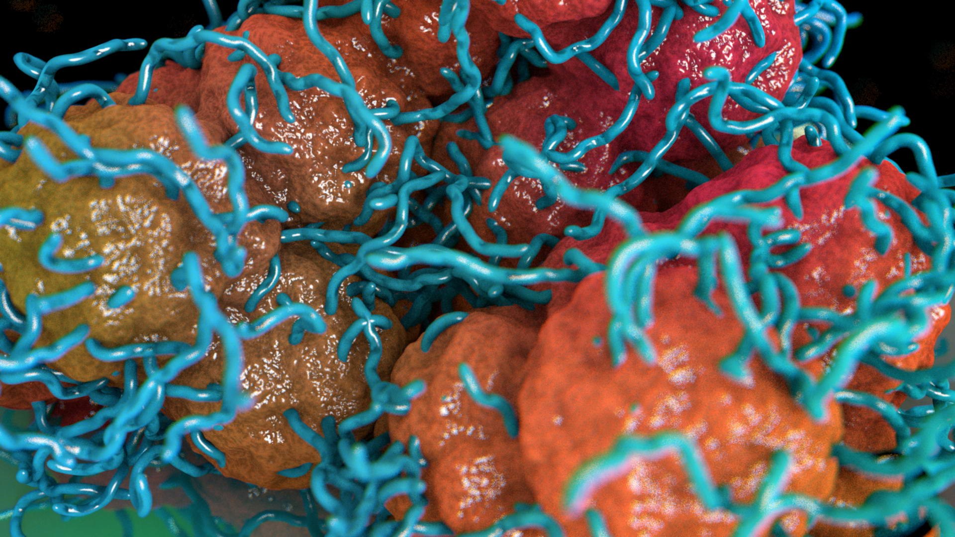 3d Lysosome Lipofuscin Proteins Aggregate Model