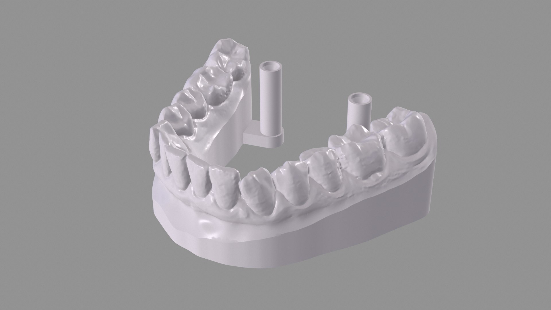 Dental printable realistic jawbones and a tooth 3D - TurboSquid 2036918