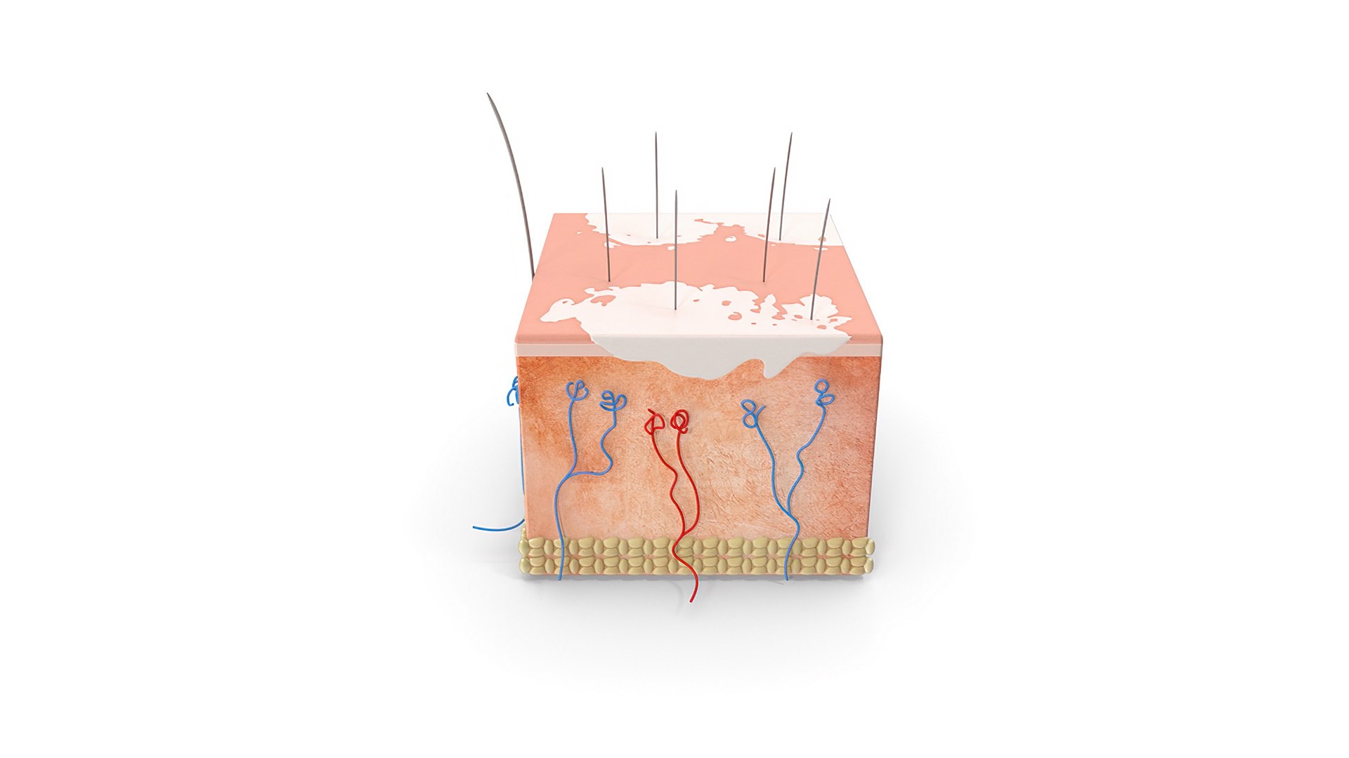 Vitiligo Skin Structure 3D Model - TurboSquid 2024385