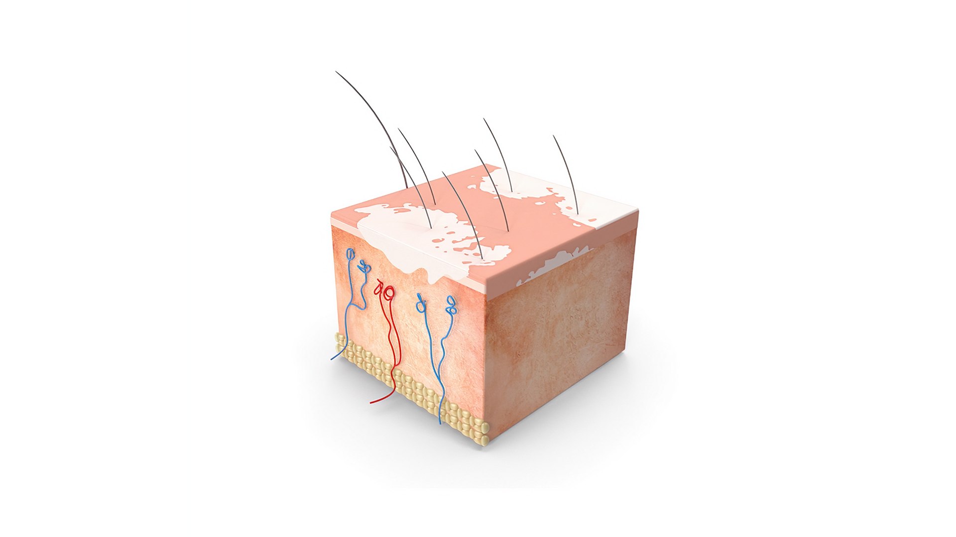 Vitiligo Skin Structure 3D Model - TurboSquid 2024385