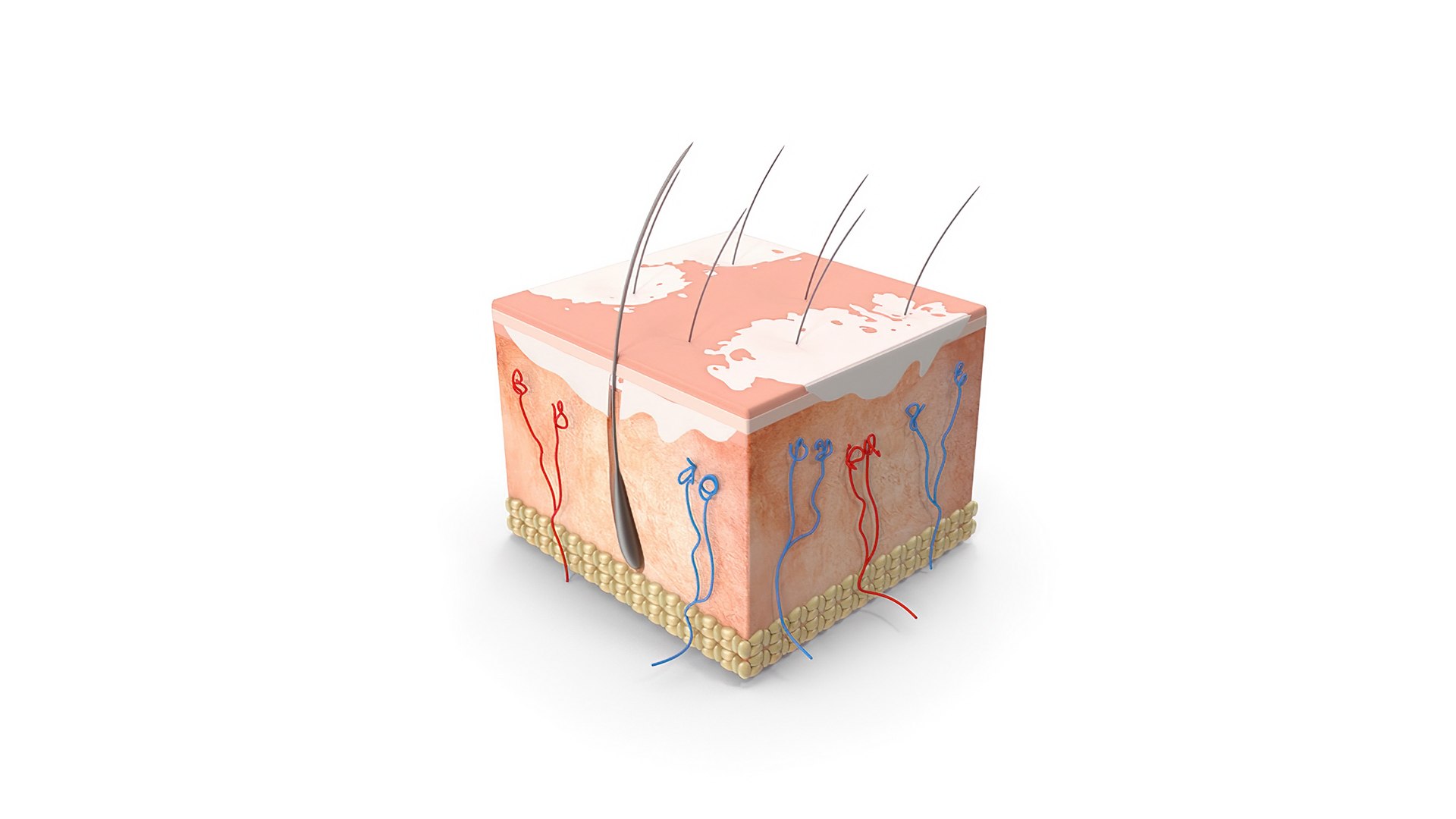 Vitiligo Skin Structure3D模型 - TurboSquid 2024385