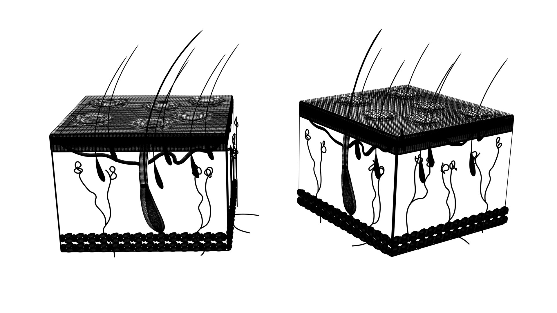 Vitiligo Skin Structure 3D Model - TurboSquid 2024385