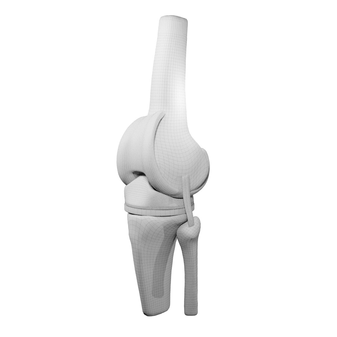 3D Knee Replacement Model - TurboSquid 1520233