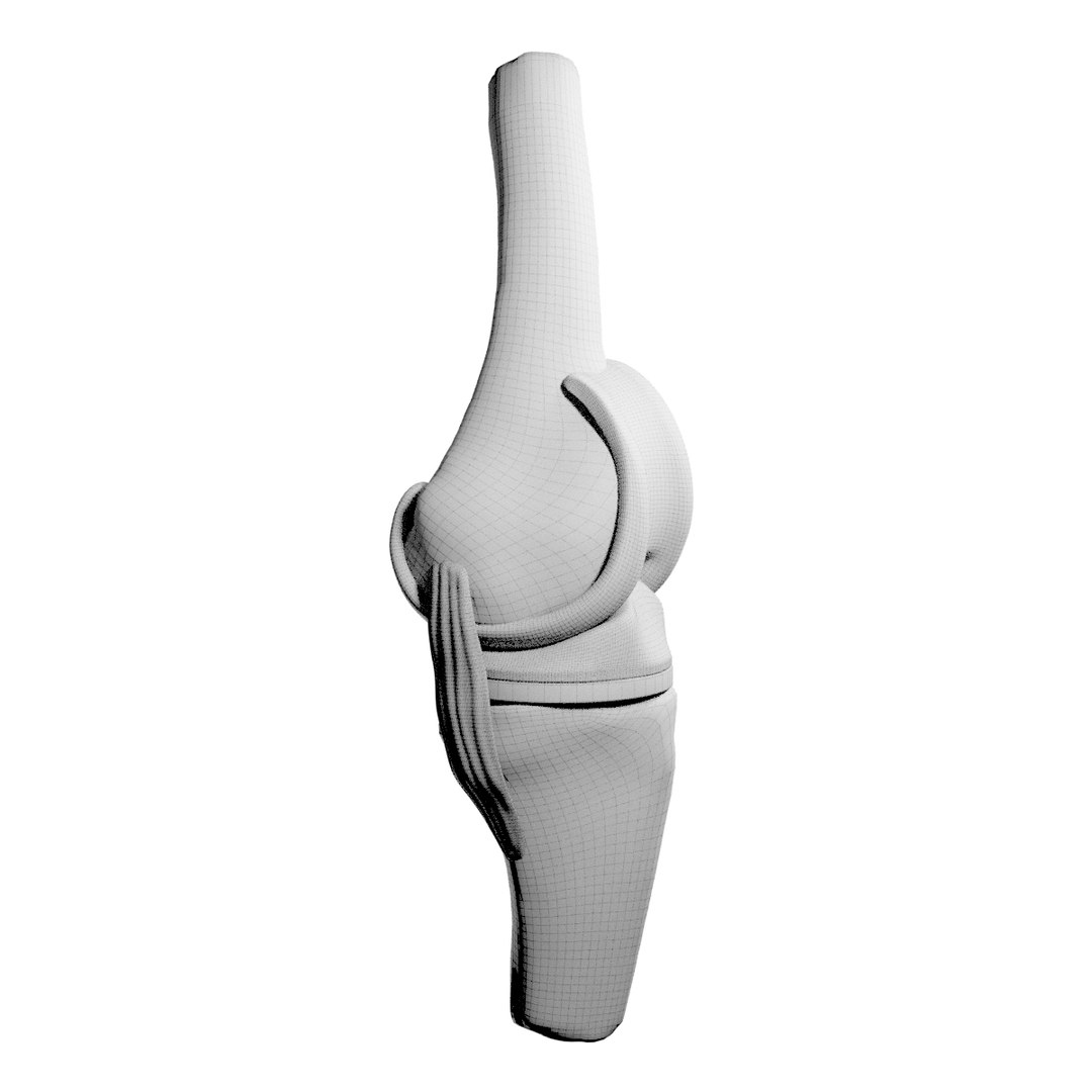 3D Knee Replacement Model - TurboSquid 1520233