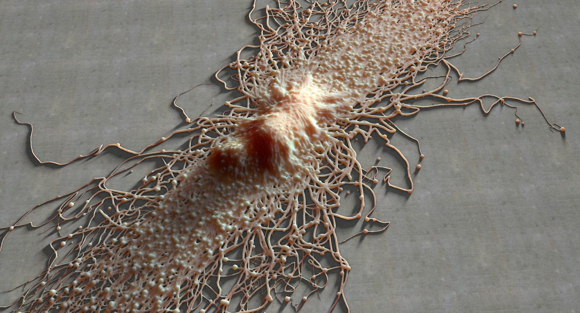 extremely fibroblast obj