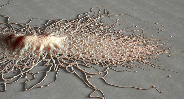 extremely fibroblast obj