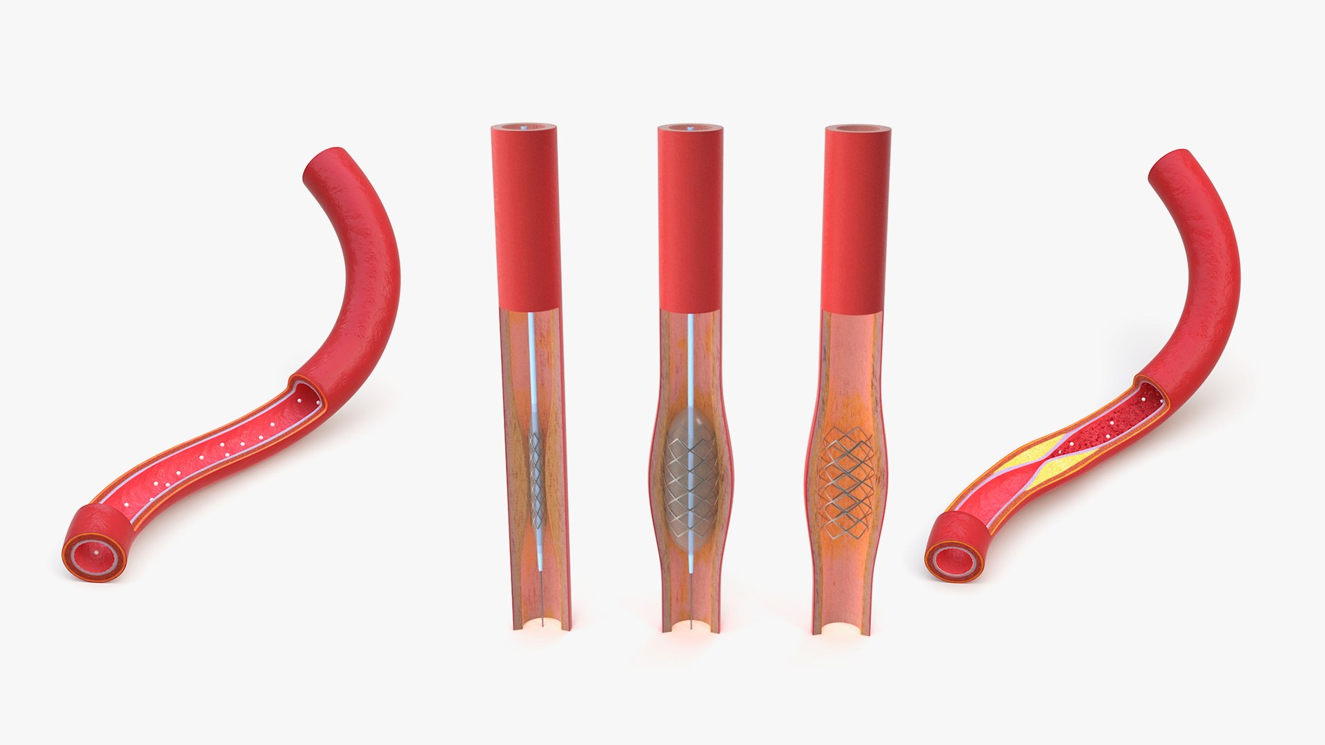 Arteries In Cross Section Collection Model - TurboSquid 2346608