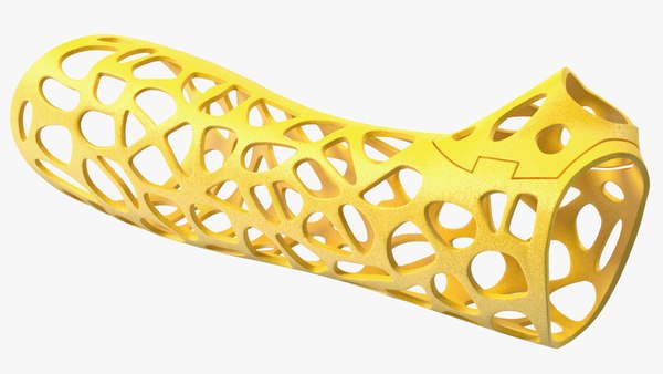 3D model 3D-Printed Orthopedic Cast Hand Yellow - TurboSquid 1900349