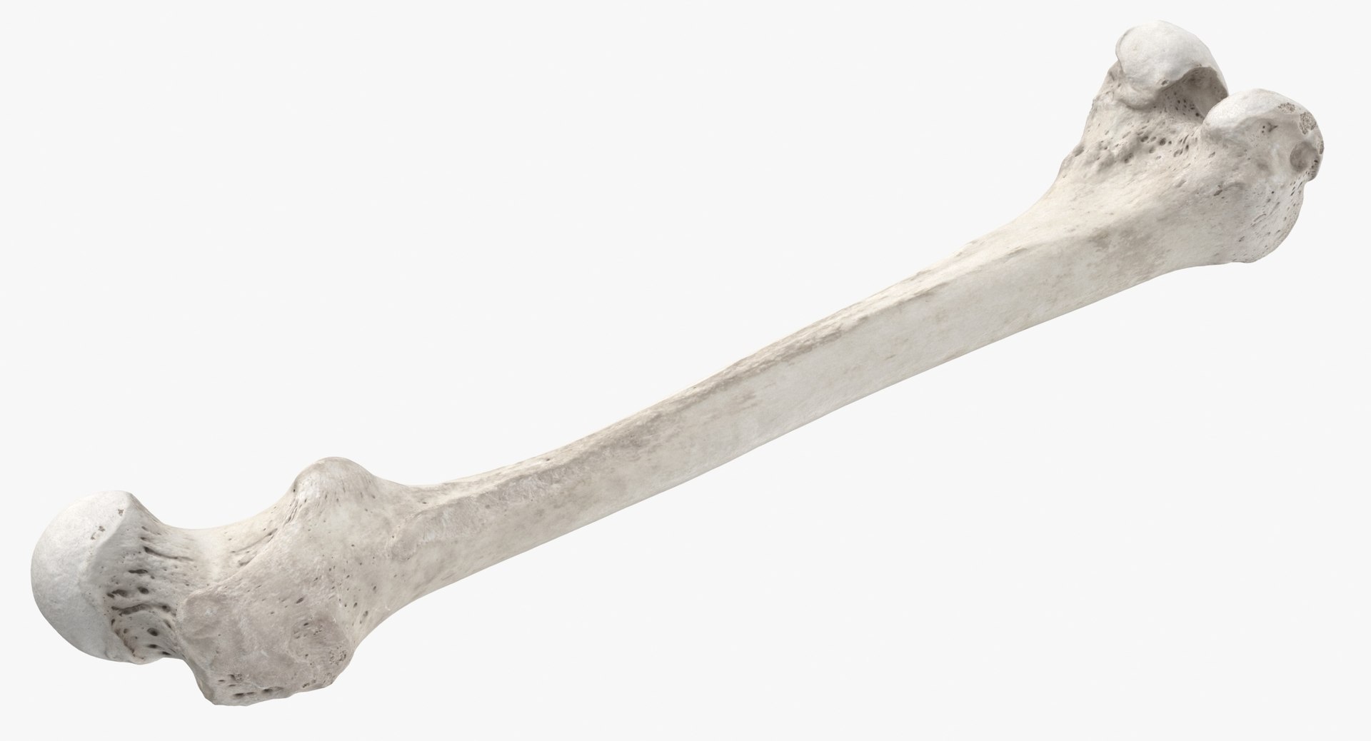 Human Femur Bone 01 3D Model - TurboSquid 1535240