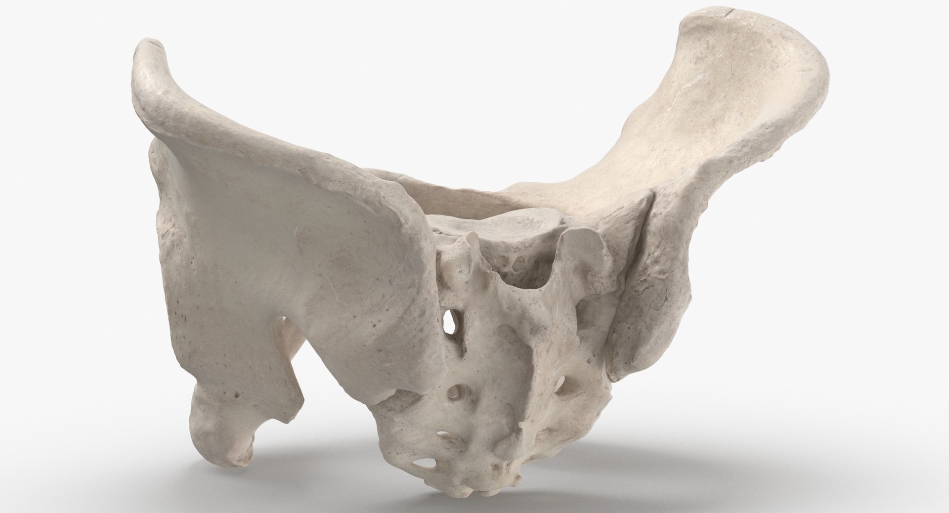 3D Human Pelvis Damaged Sacrum Model - TurboSquid 1546713