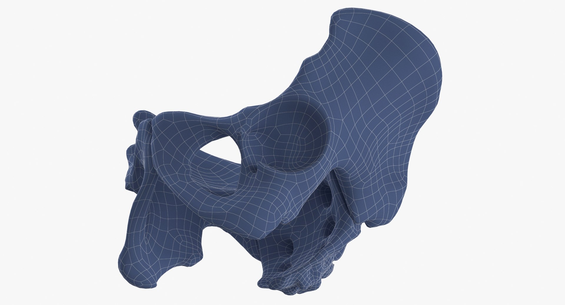 3D Human Pelvis Damaged Sacrum Model - TurboSquid 1546713
