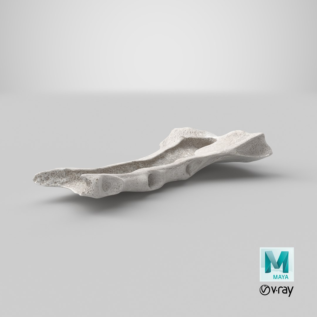 3D Real Damaged Open Sternum Model - TurboSquid 1662403
