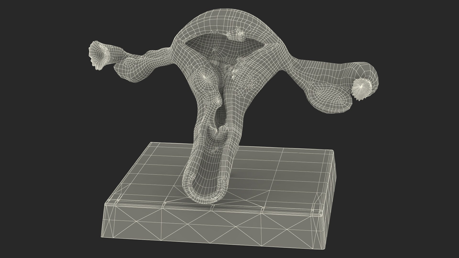Layout Anatomy Female Uterus model - TurboSquid 2097722
