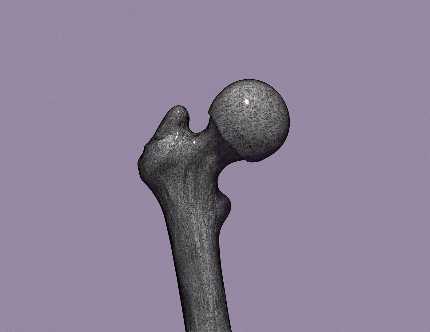 3D Human Femur For 3D Printing - TurboSquid 1947068