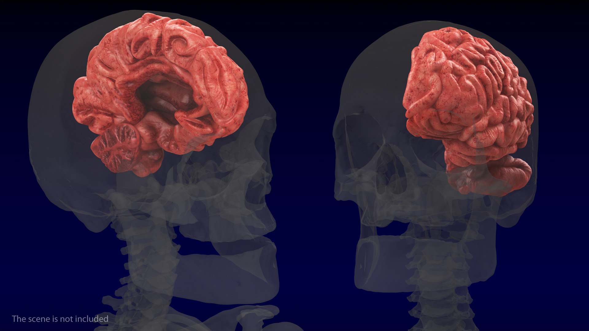 3D Human Brain Left Hemisphere - TurboSquid 1467043