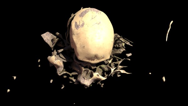 Broken skull model - TurboSquid 1698432