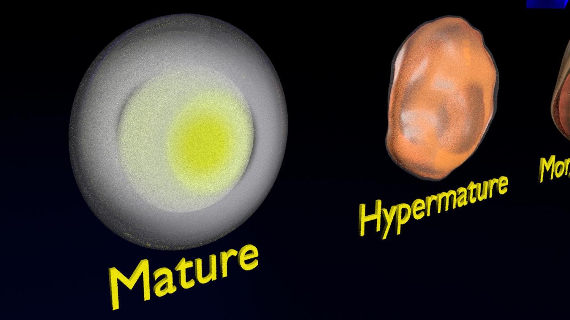 3D cataract eye lens types detailed animated model - TurboSquid 1774837