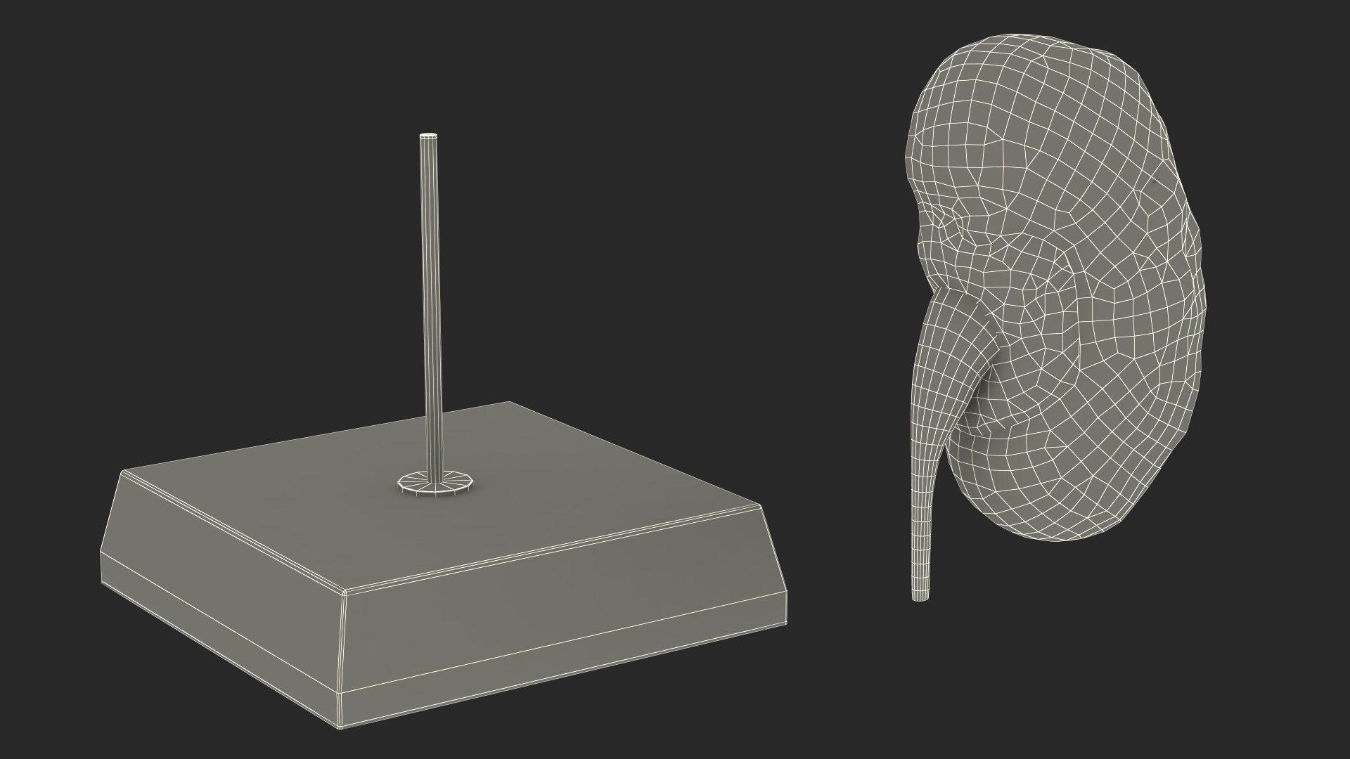 3D Polycystic Kidney Disease Model On Stand - TurboSquid 2411099