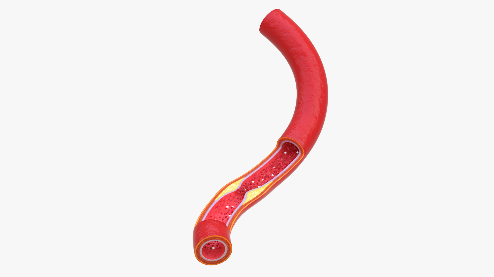 Human Cholesterol Artery Anatomy Model - TurboSquid 2330259