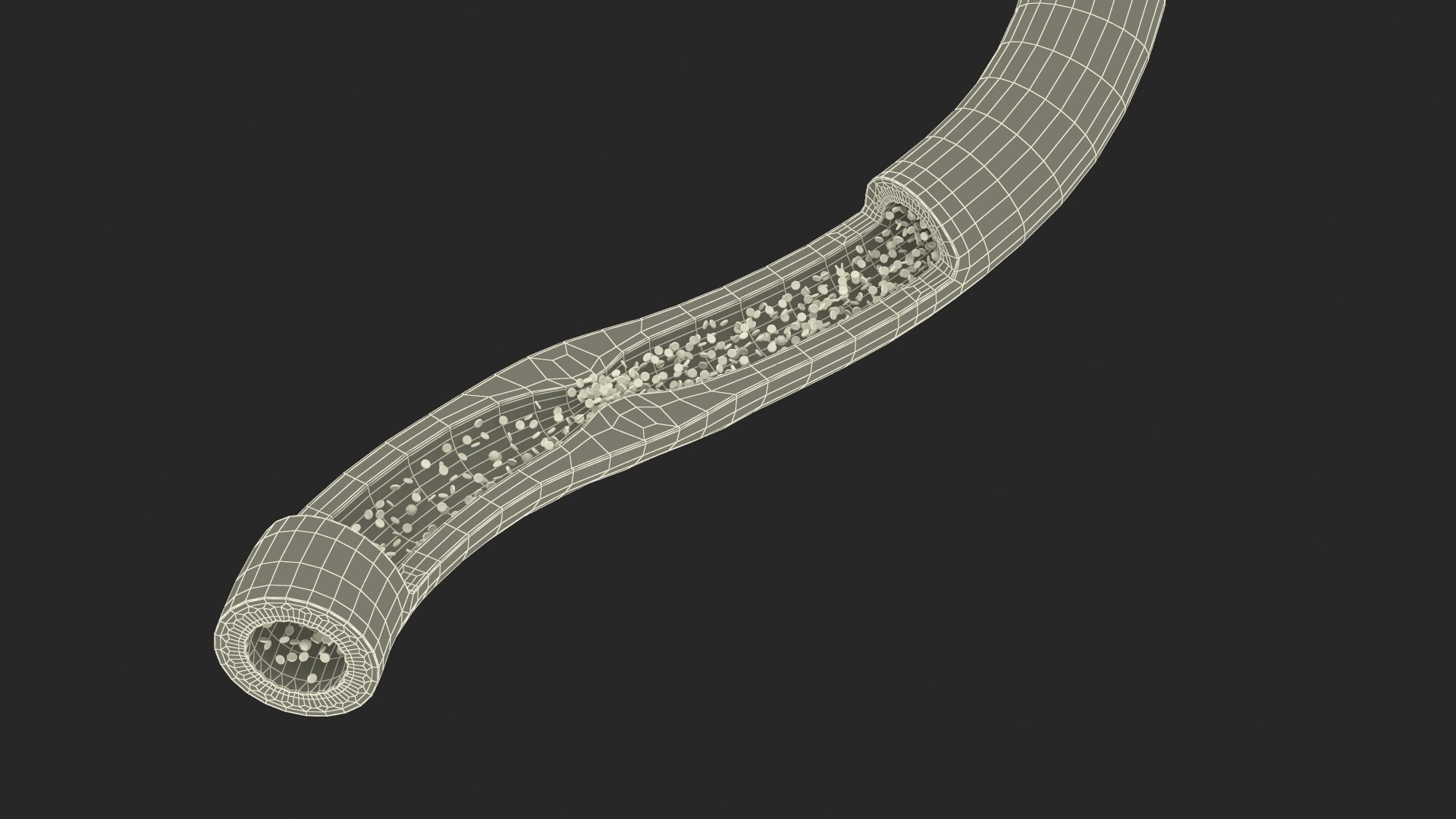 Human Cholesterol Artery Anatomy Model - TurboSquid 2330259