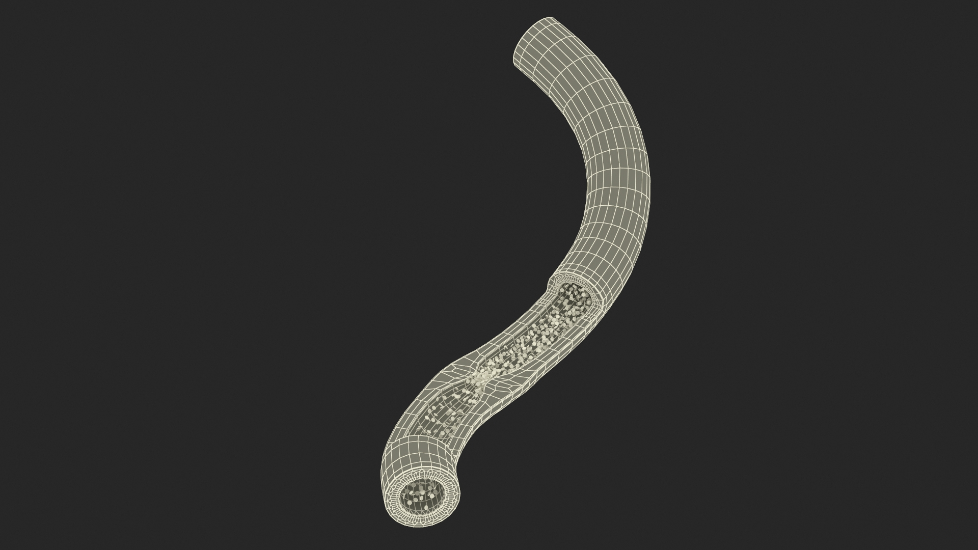 Human Cholesterol Artery Anatomy Model - TurboSquid 2330259