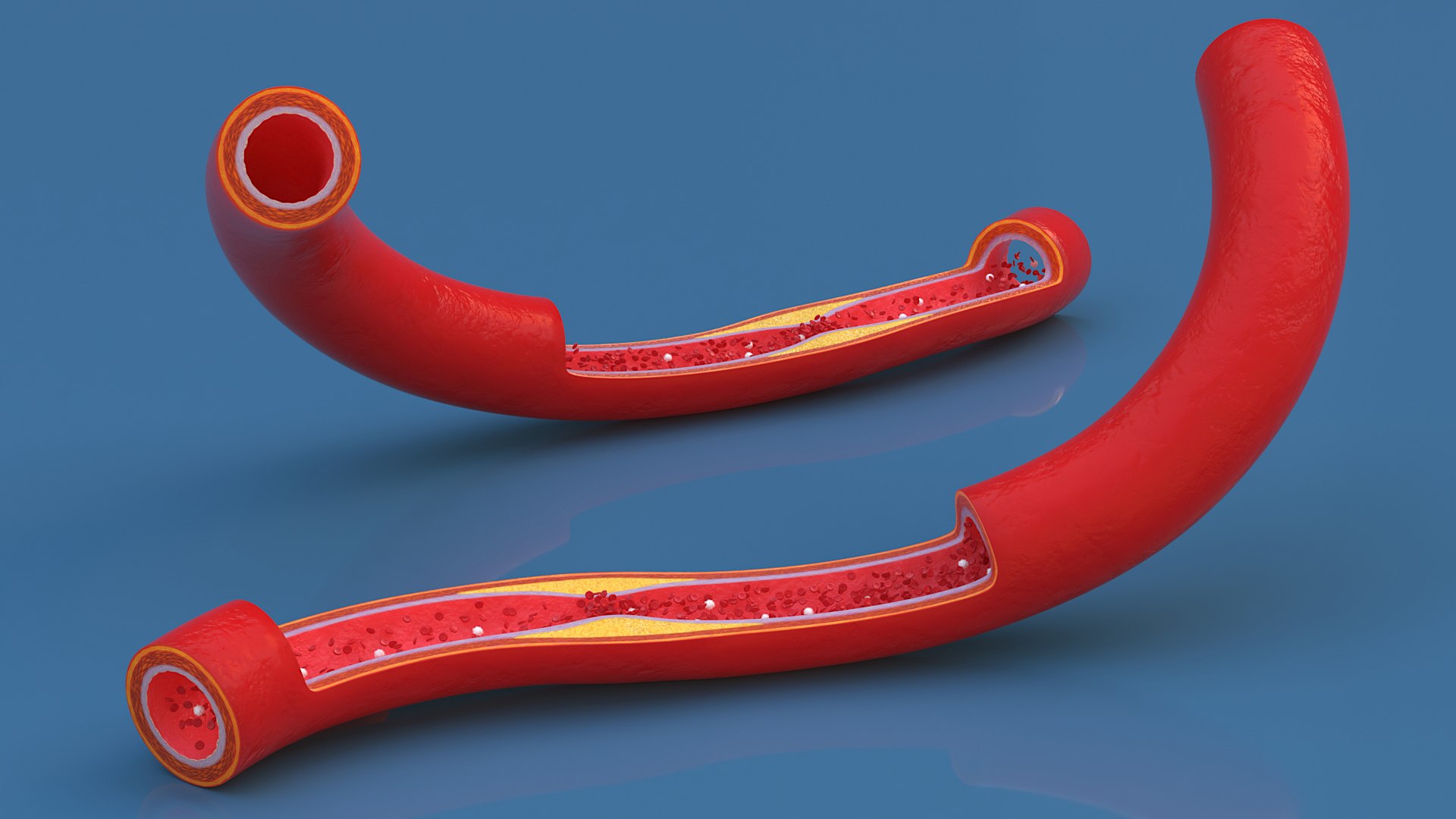 Human Cholesterol Artery Anatomy Model - TurboSquid 2330259
